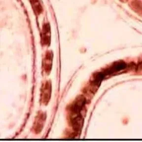 Ask IFAS: Common Freshwater Fish Parasites series