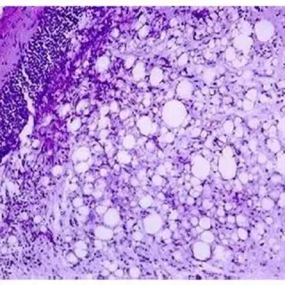 FA180/FA180: Viral Nervous Necrosis (Betanodavirus) Infections in Fish