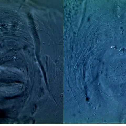 Ask IFAS: Topic - Root-knot Nematodes