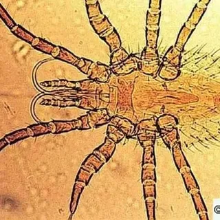 EENY-297/IN575: Tropical Fowl Mite, Ornithonyssus bursa (Berlese ...